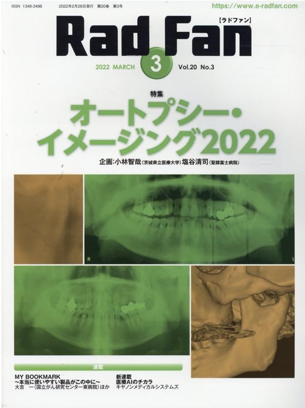 Rad Fan Vol.20No.3