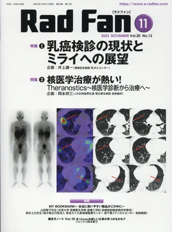 Rad Fan 2022 NOVEMBER