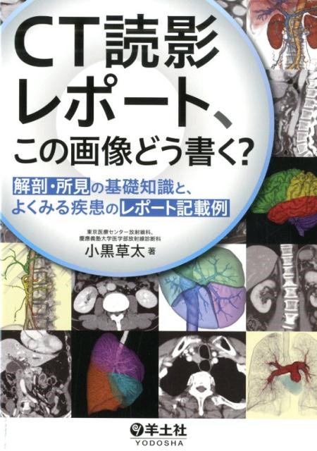 CT読影レポート、この画像どう書く? 解剖・所見の基礎知識と、よくみる疾患のレポート記載例/小黒草太